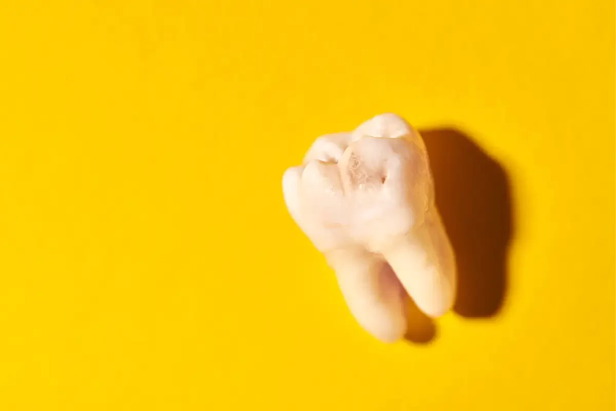 Tooth Extraction: Your Guide to a Stress-Free Visit